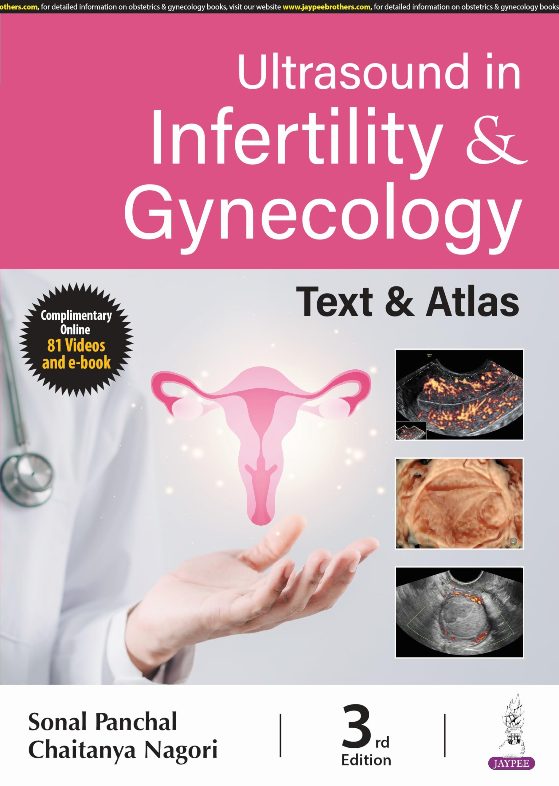 Buy Ultrasound in Infertility & Gynecology: Text & Atlas Book Online at Low Prices in India ...