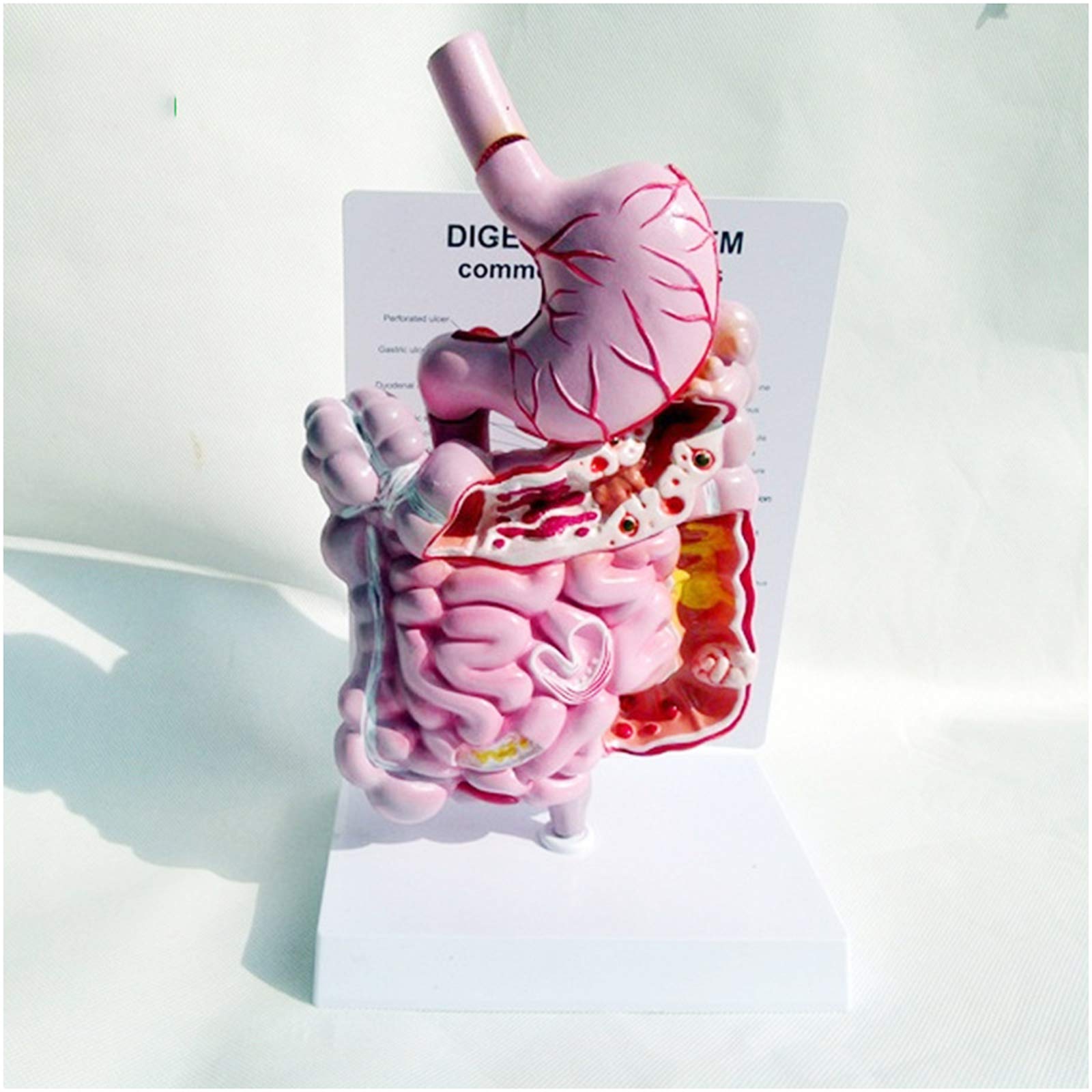 Buy FHUILI Large Intestine Model - Human Organ Anatomy Model Anatomical ...