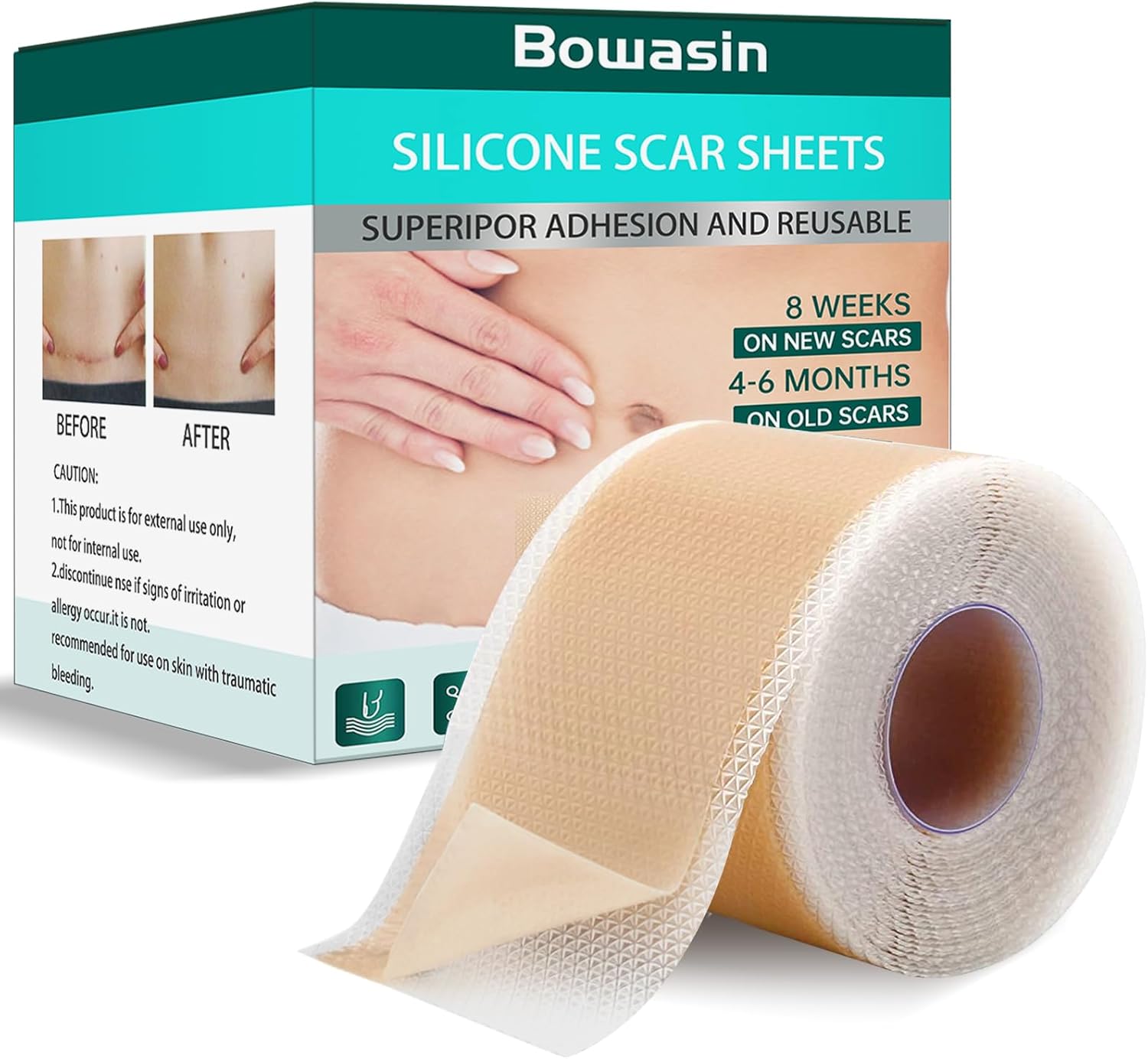 Silicone Scar Sheets (1.6'' x 60''Roll-1.5M) Silicone Scar Tape ...
