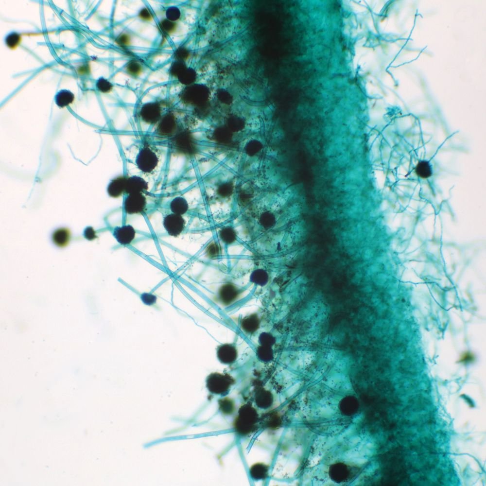 Aspergillus Conidia