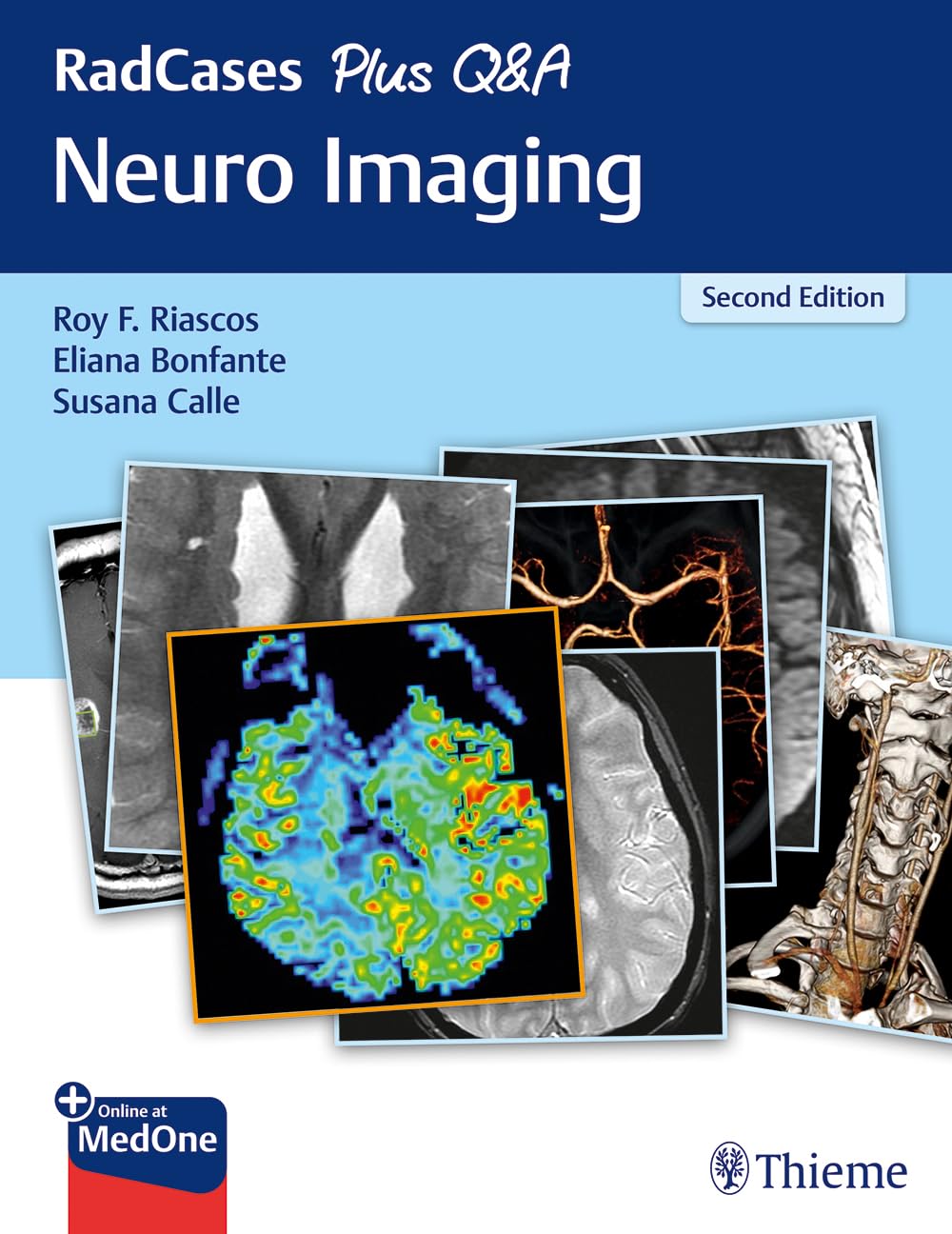 RadCases Plus Q&A Neuro Imaging: 9781626232372: Medicine & Health ...