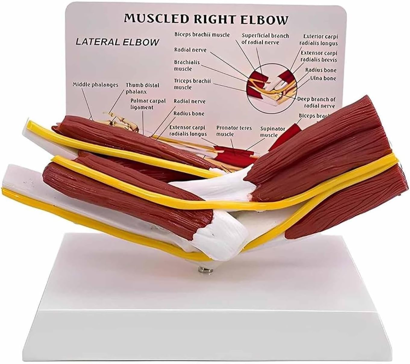 Amazon.com: Human Elbow Joint Anatomy Model,Right Elbow Joint Model ...