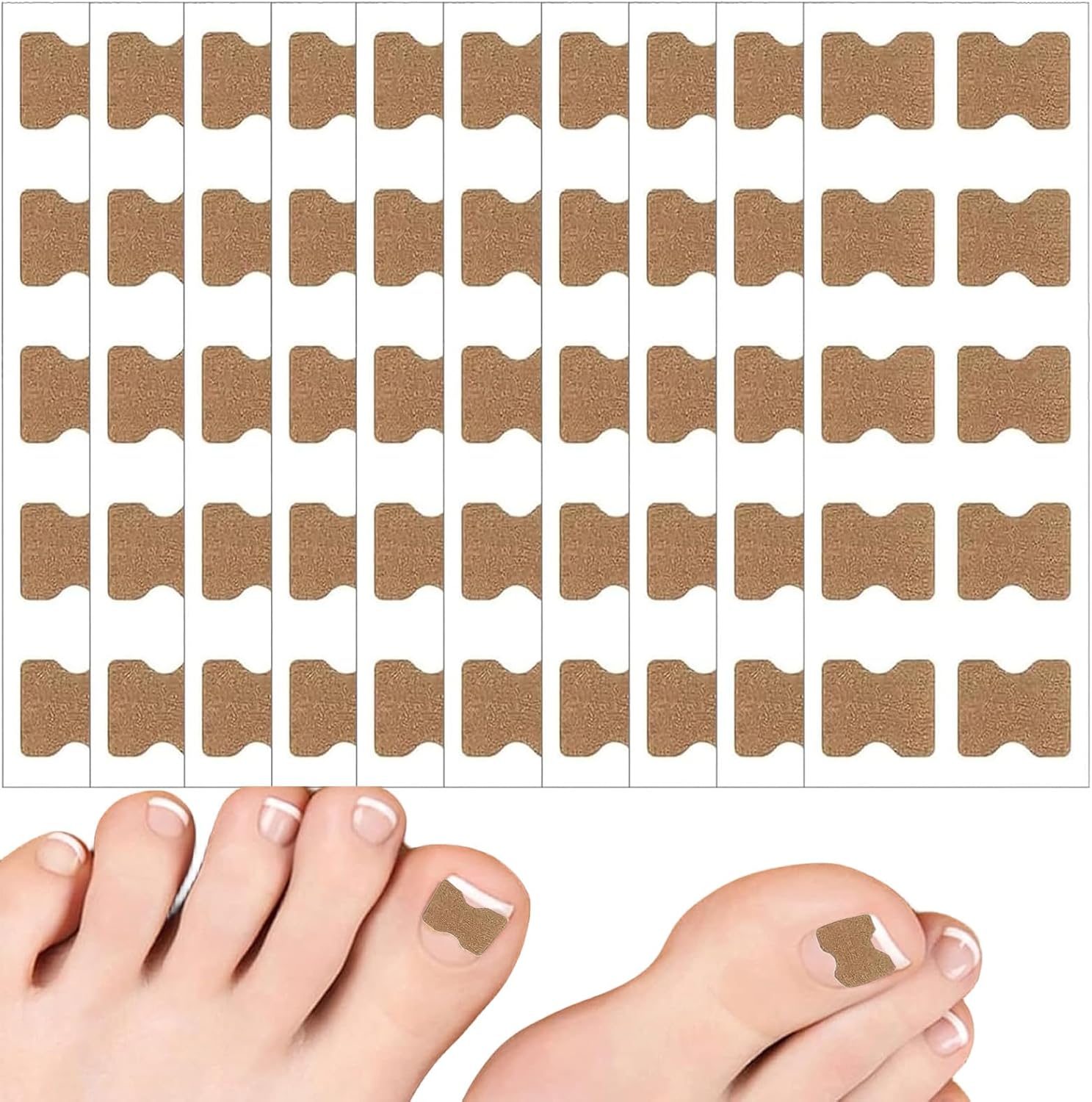 100Pcs Ingrown Toenail Treatment Toe Daily Home Use,for The Treatment ...