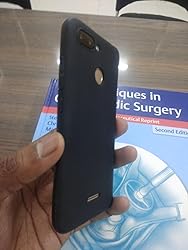 Redmi 6 (Gold, 3GB RAM, 64GB Storage) : Amazon.in: Electronics