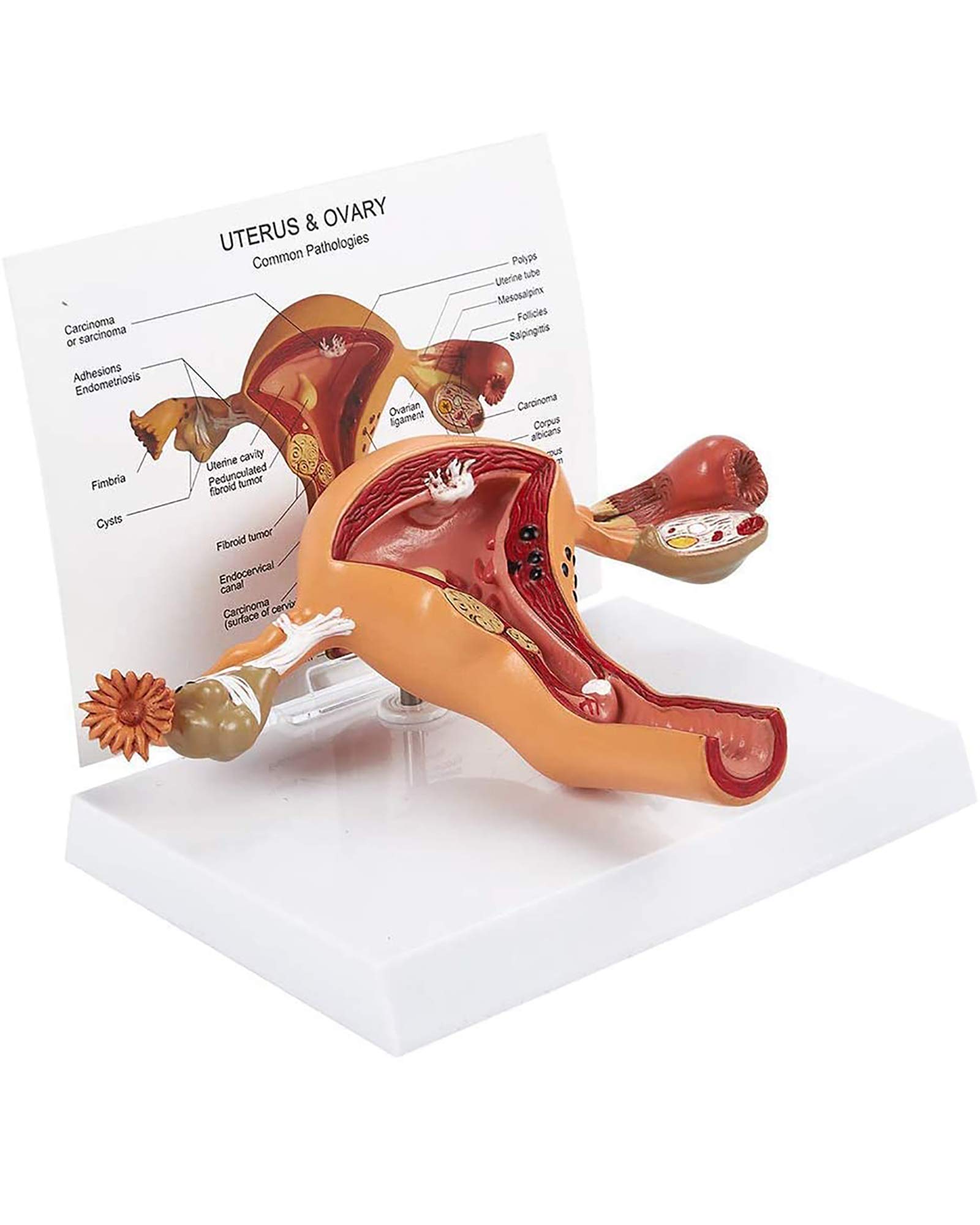 Buy PVC Female Uterine Ovary Uterine Pathology Model Uterus and Ovary ...