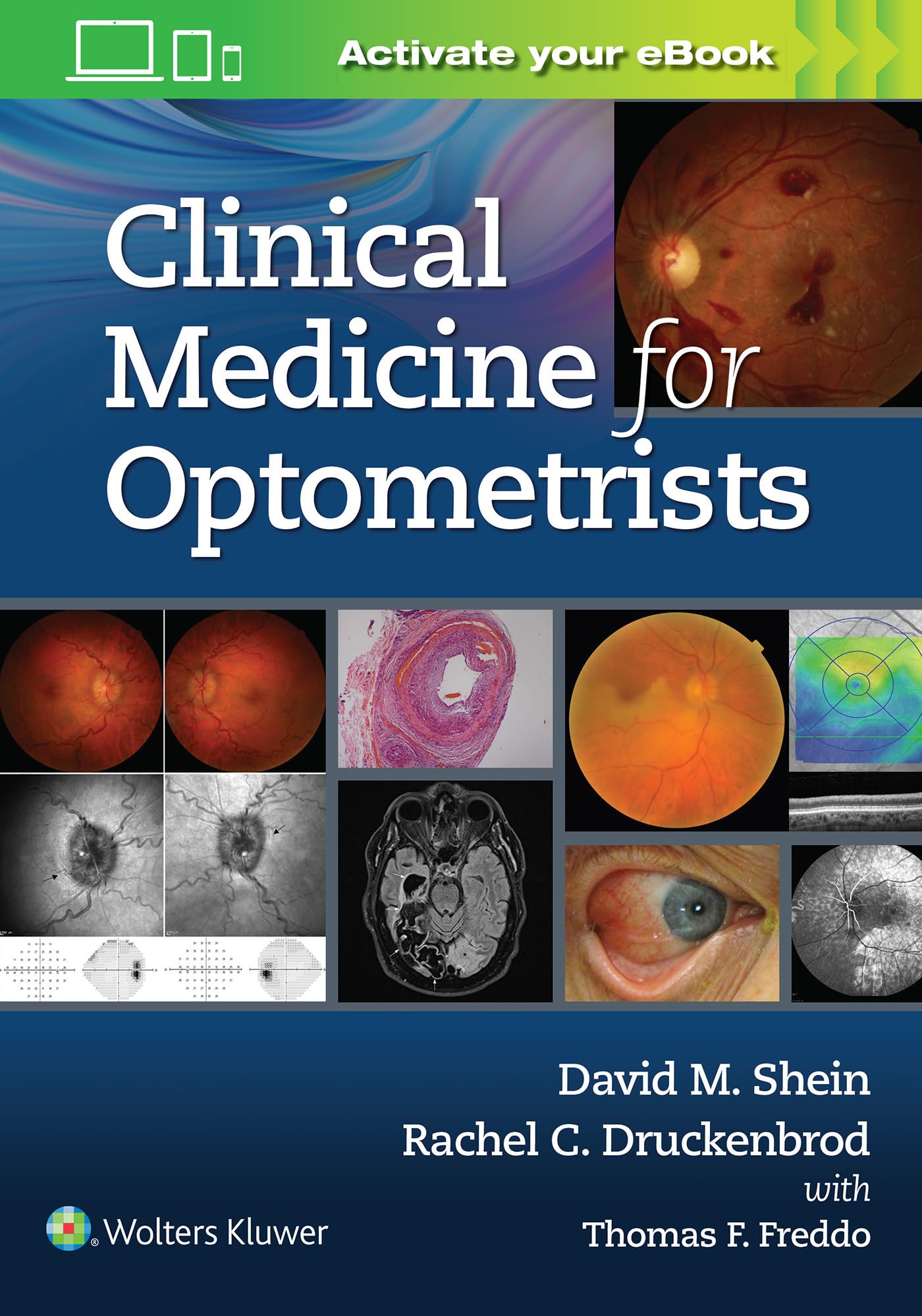 Clinical Medicine for Optometrists: 9781975146511: Medicine & Health ...
