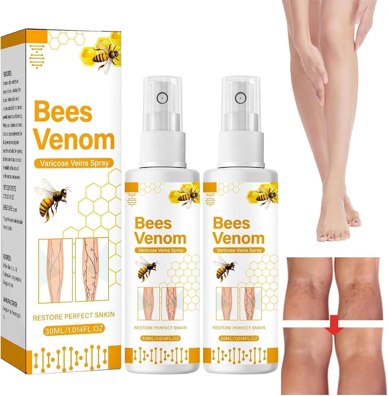 Buy Bee Venom Varicose Veins Spray, Varicose Veins for Legs, Spider ...