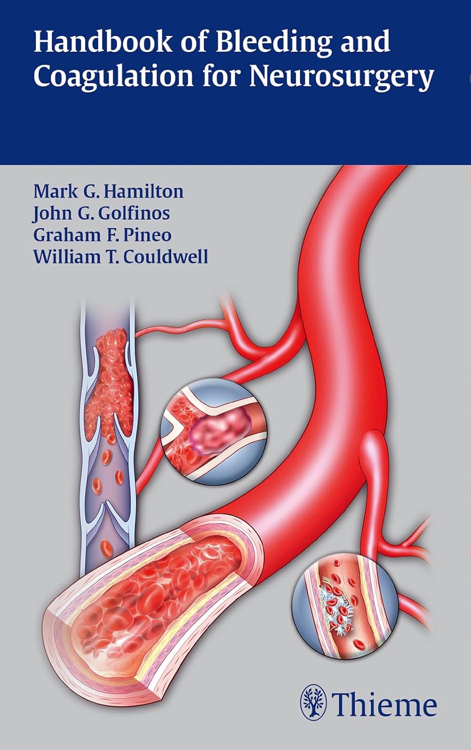 Handbook of Bleeding and Coagulation for Neurosurgery: 9781604065442 ...