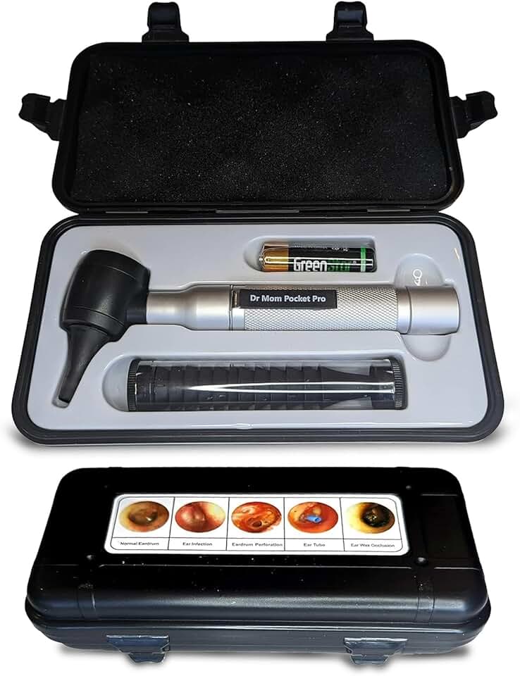 Amazon.co.uk: Auroscope