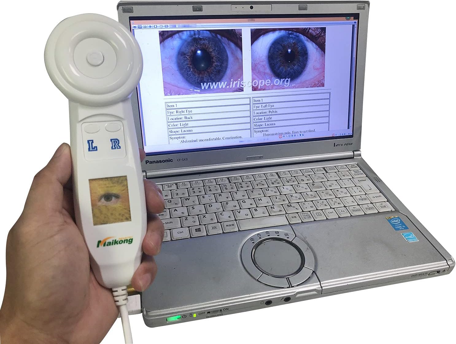 USB Iridology Camera Portable Iriscope Iris Analyzer with English and ...