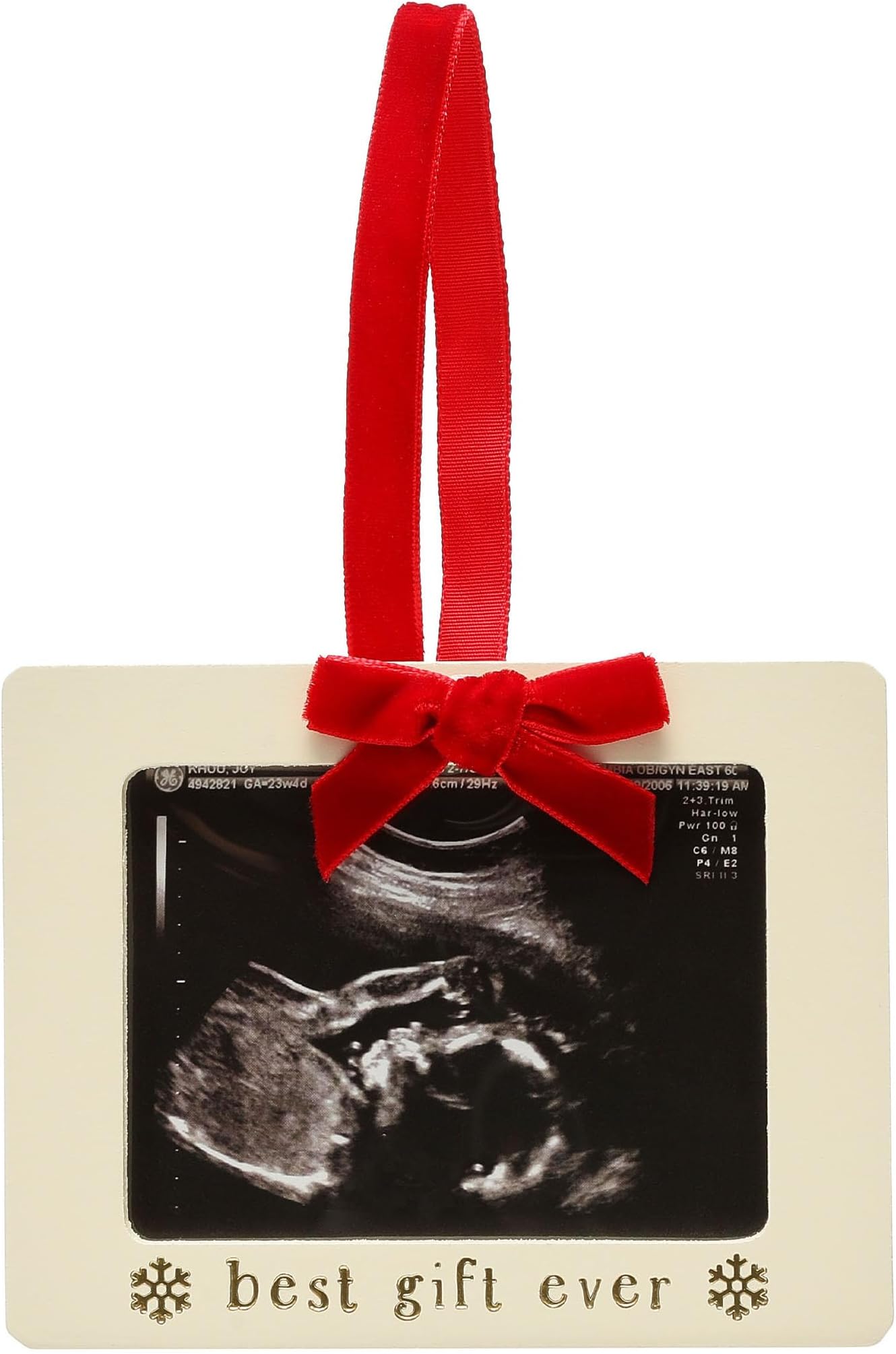 Amazon.com: Pearhead Baby Sonogram Christmas Ornament, Newborn Holiday ...