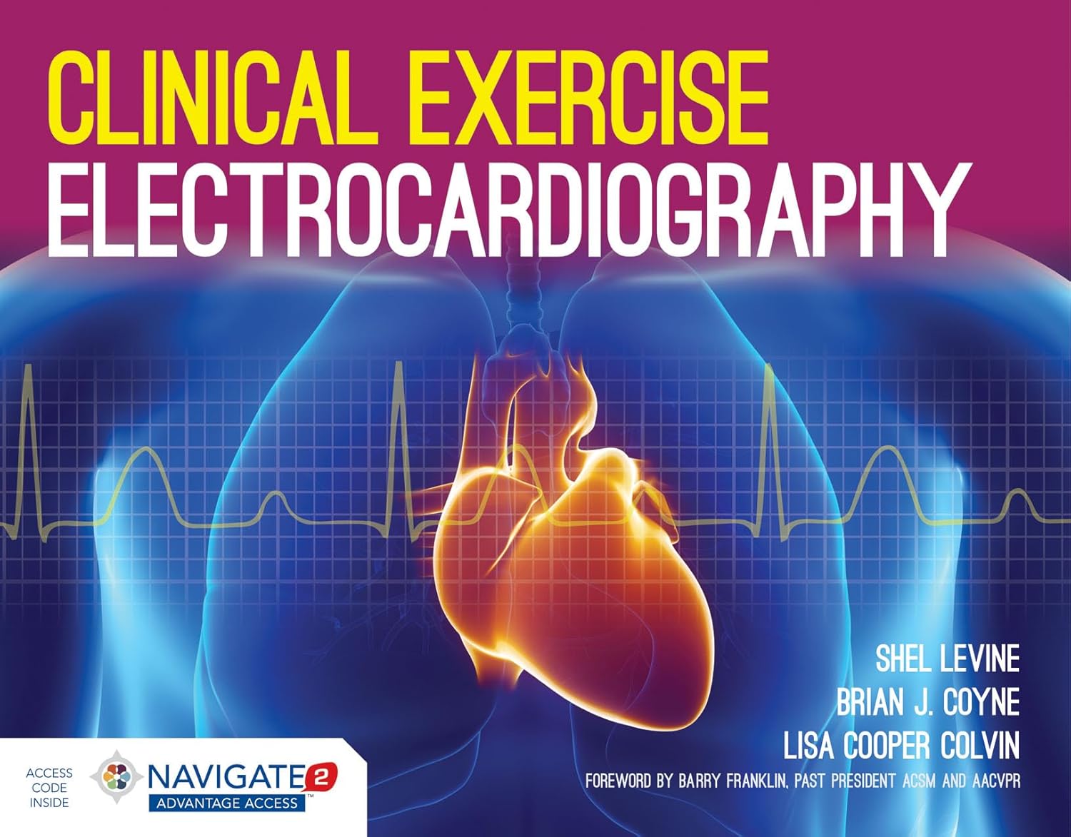Clinical Exercise Electrocardiography - Includes Navigate 2 Advantage ...