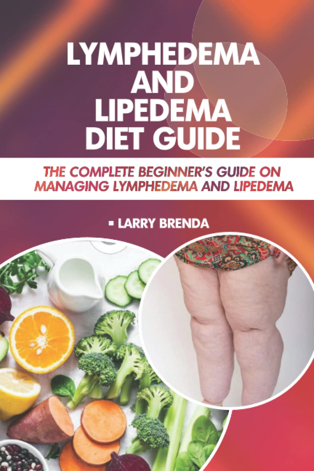Lymphedema and Lipedema Diet Guide: The Complete Beginner’s Guide On ...