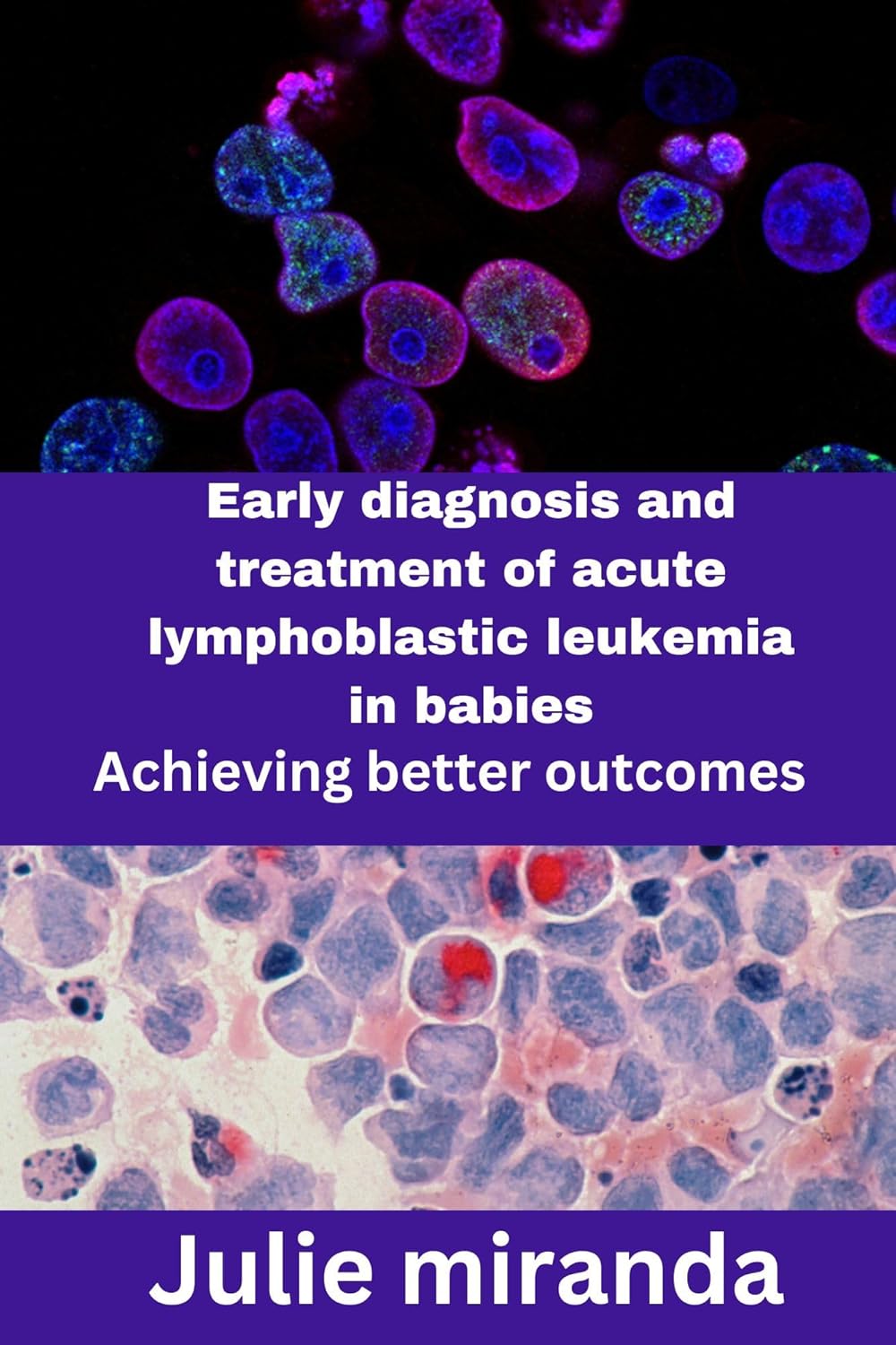 Amazon.com: Early diagnosis and treatment of acute lymphoblastic ...