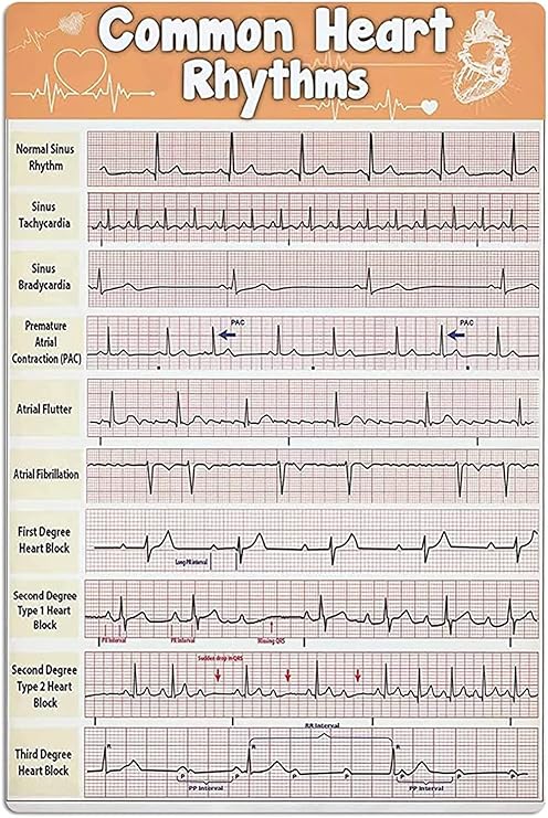 Amazon.com: Starotore Ekg Knowledge Metal Tin Signs Vintage Common ...