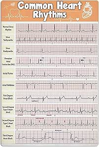 Amazon.com: Starotore Ekg Knowledge Metal Tin Signs Vintage Common ...