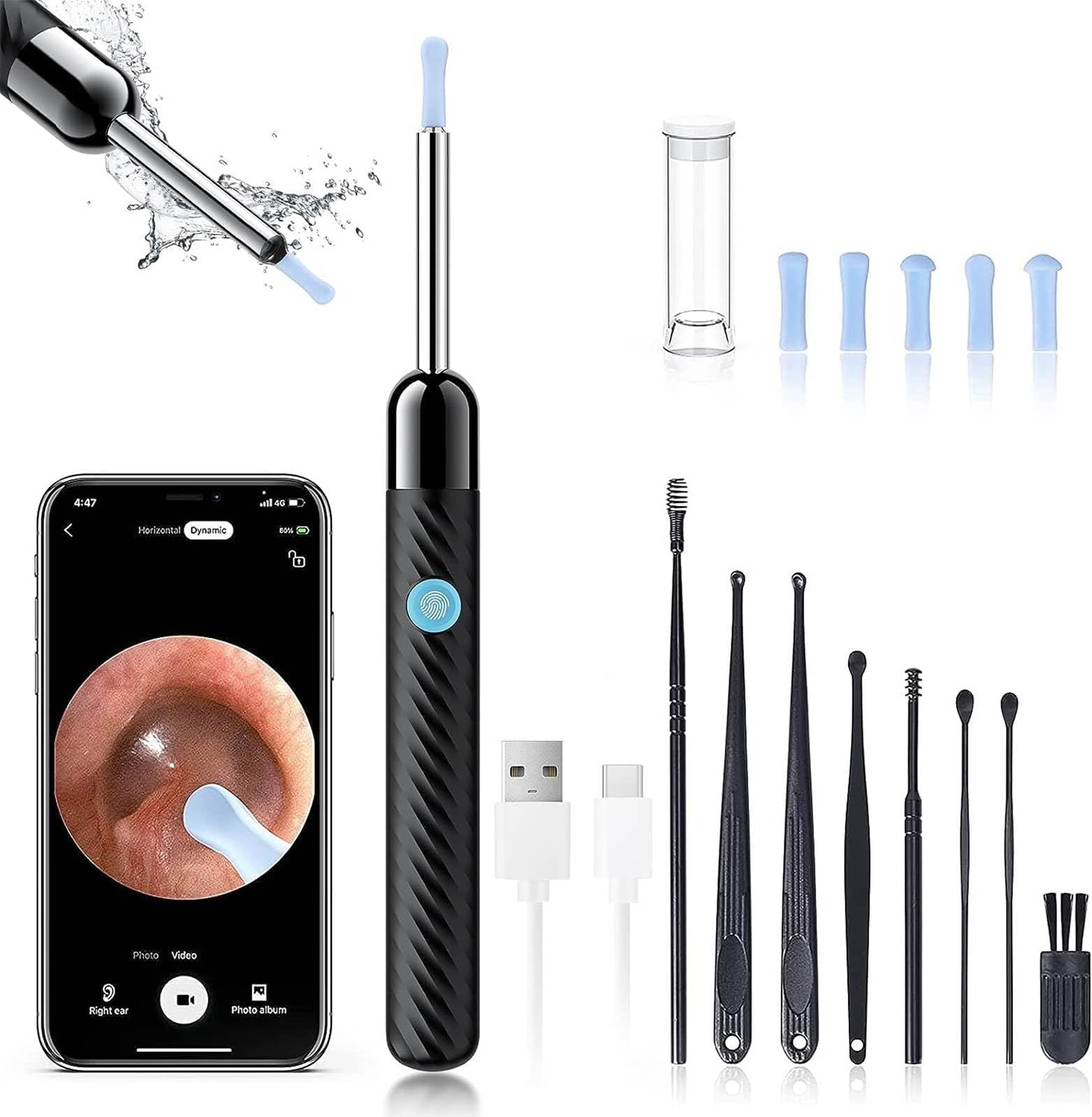 Amazon.com: Bebird Earsight Plus Ear Wax Removal Tool Camera, Ear ...