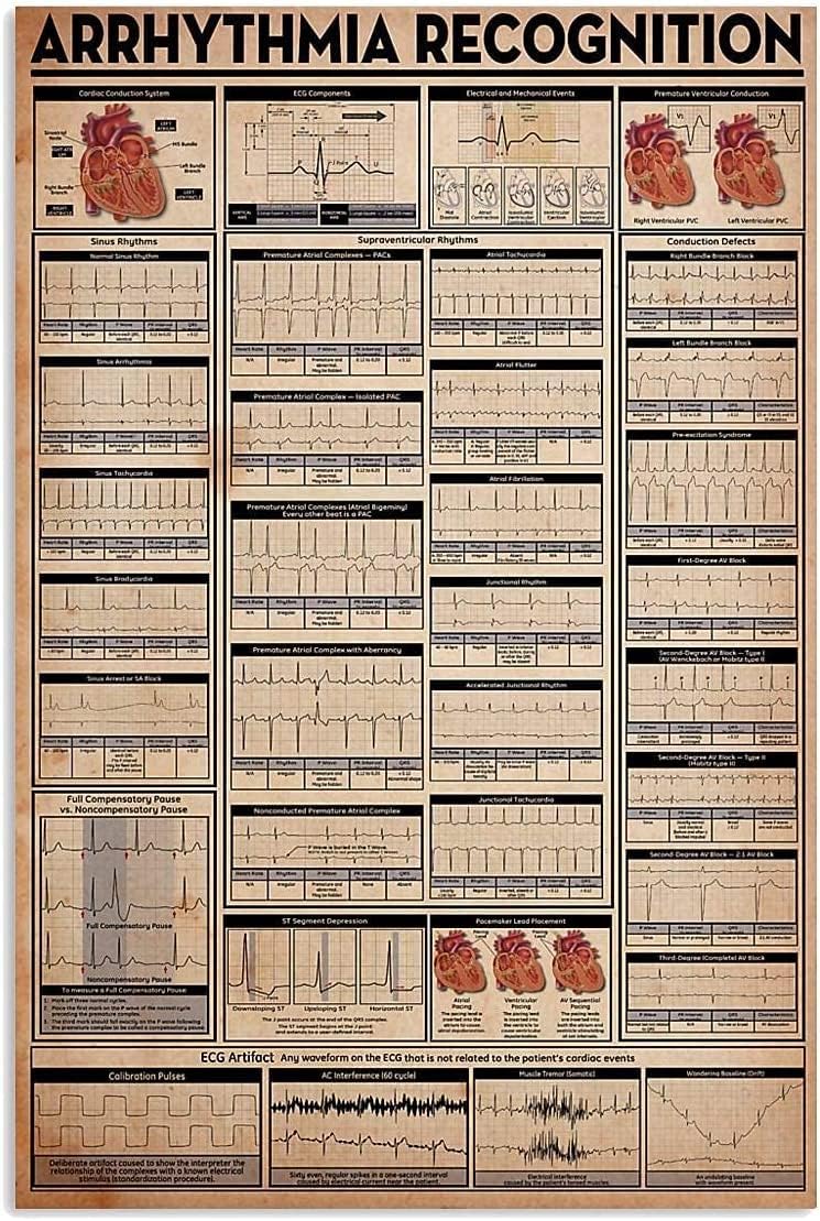 Amazon.com: Cardiology Knowledge Metal Signs Arrhythmia Recognition ...