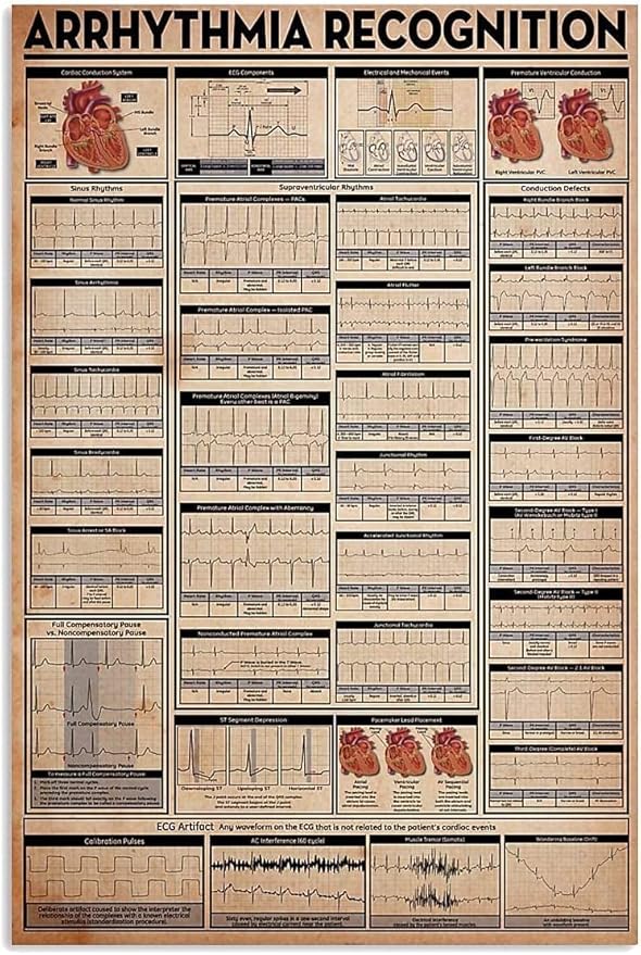 Amazon.com: Cardiology Knowledge Metal Signs Arrhythmia Recognition ...