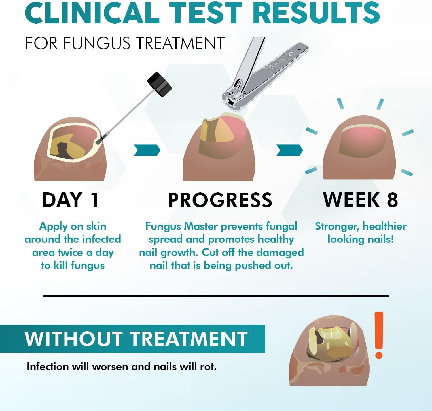 Ebanel Paquete de tratamiento para hongos en los pies de 2 onzas y ...