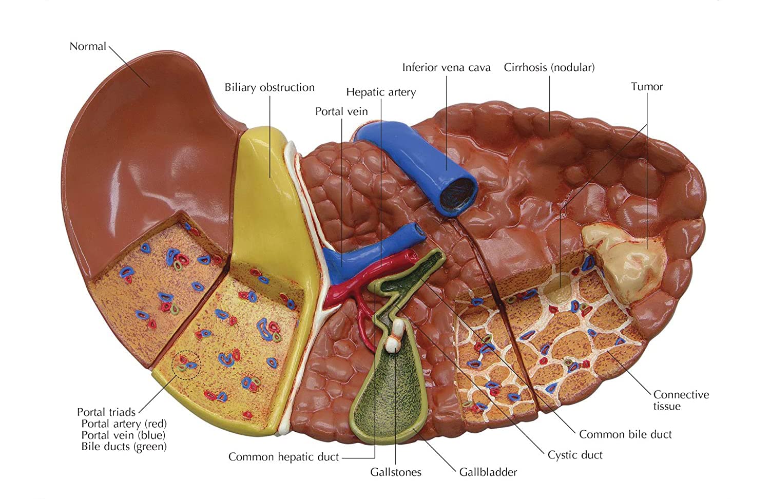 Visceral Liver