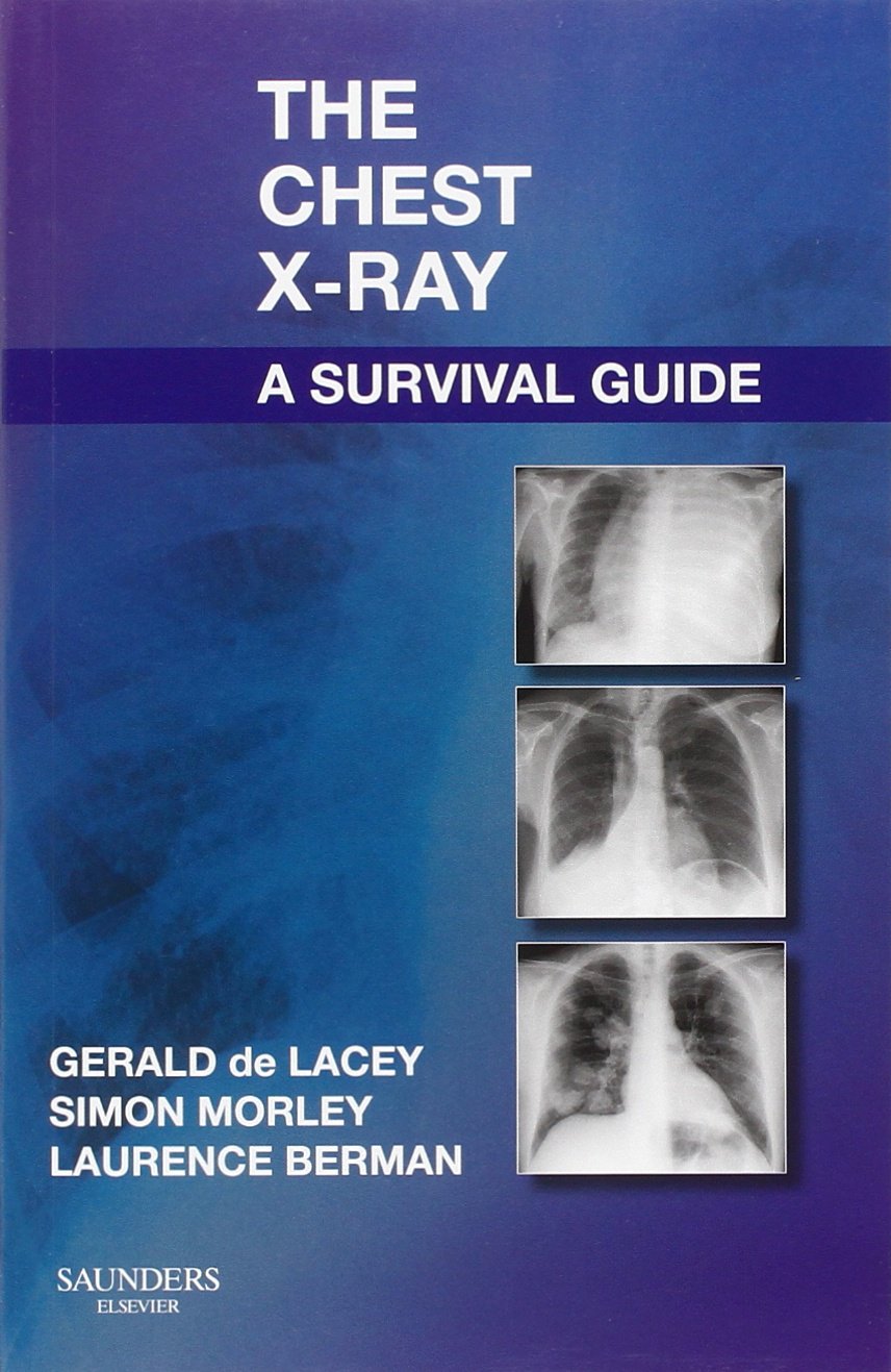 The Chest X-Ray: A Survival Guide: 9780702030468: Medicine & Health ...