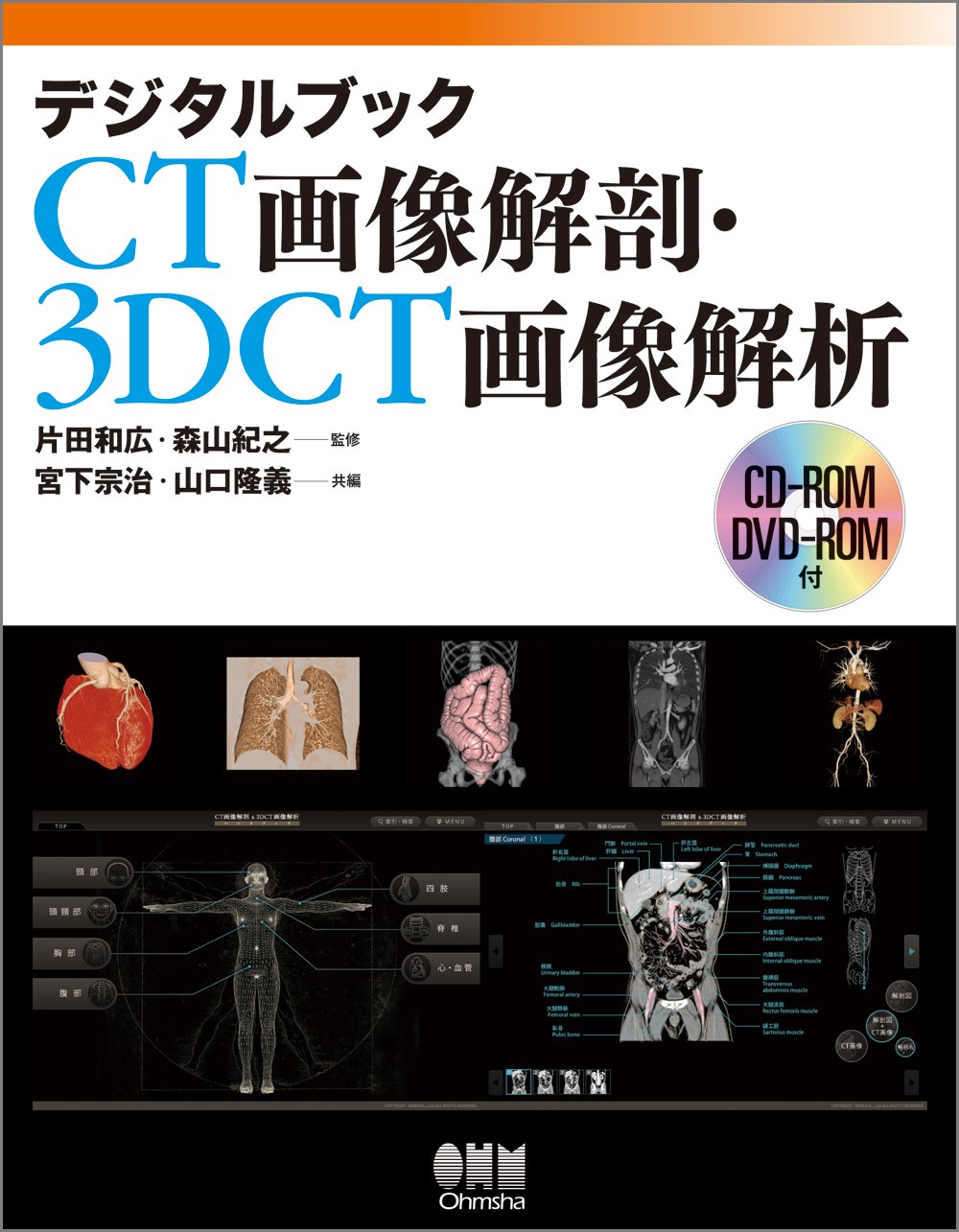 Amazon.com: Digital Book CT image anatomy ~ 3DCT image analysis (2012 ...