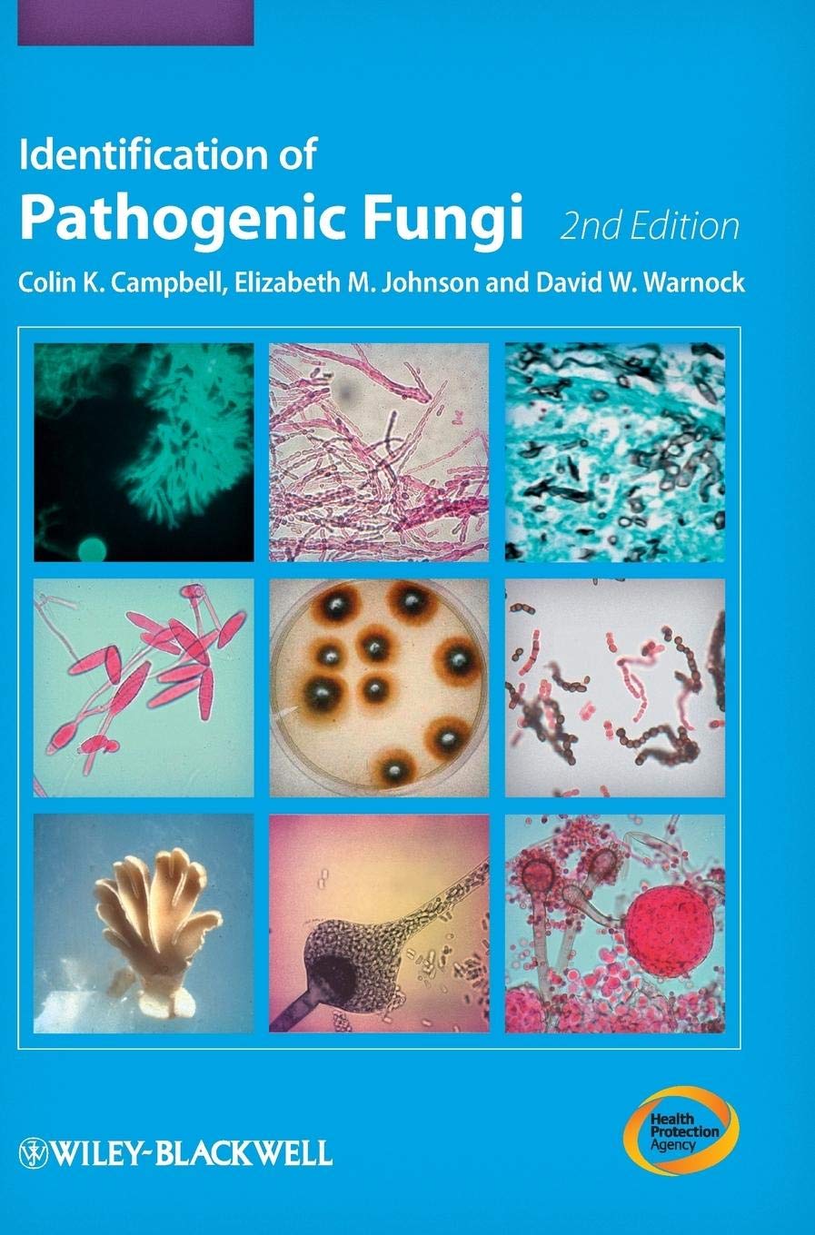 Amazon.com: Identification of Pathogenic Fungi: 9781444330700: Campbell ...