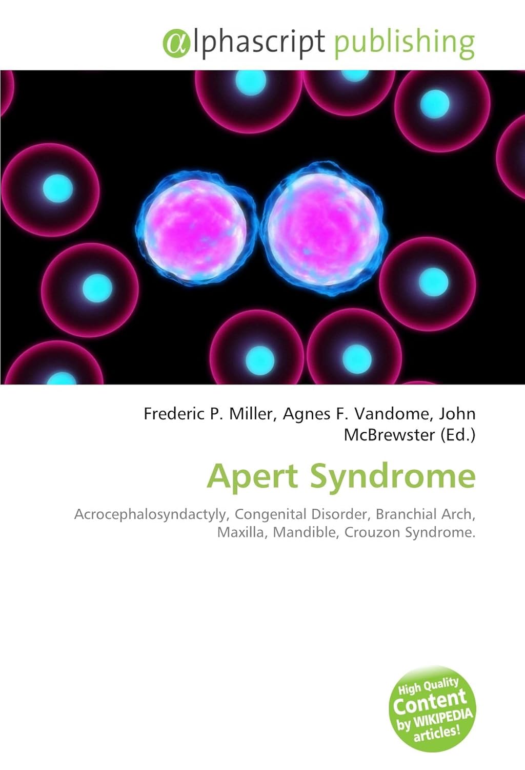 Apert Syndrome: Acrocephalosyndactyly, Congenital Disorder, Branchial ...