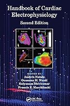 Understanding Cardiac Electrophysiology Study And Ablation: A Guide For ...