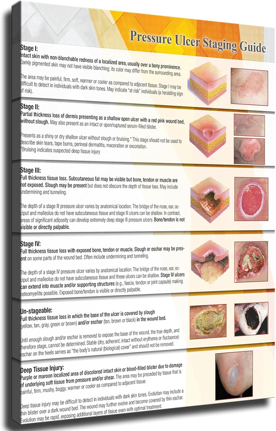 Amazon.com: HD canvas print- Patient Education Wound Care Knowledge ...