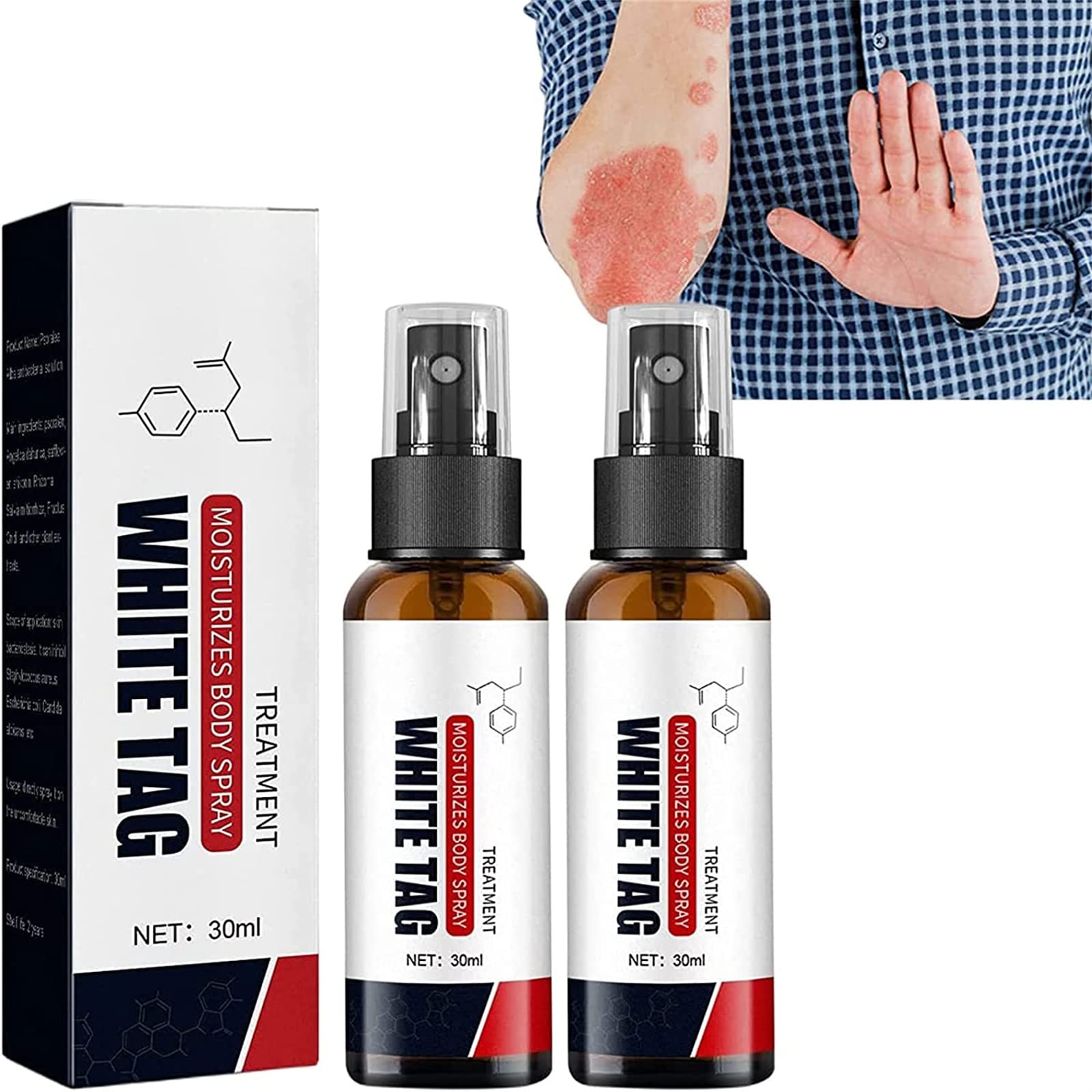 Buy Psoriasis Spray,Psoriasis Cream for Body,Vitiligo Spray,Skin Repair ...