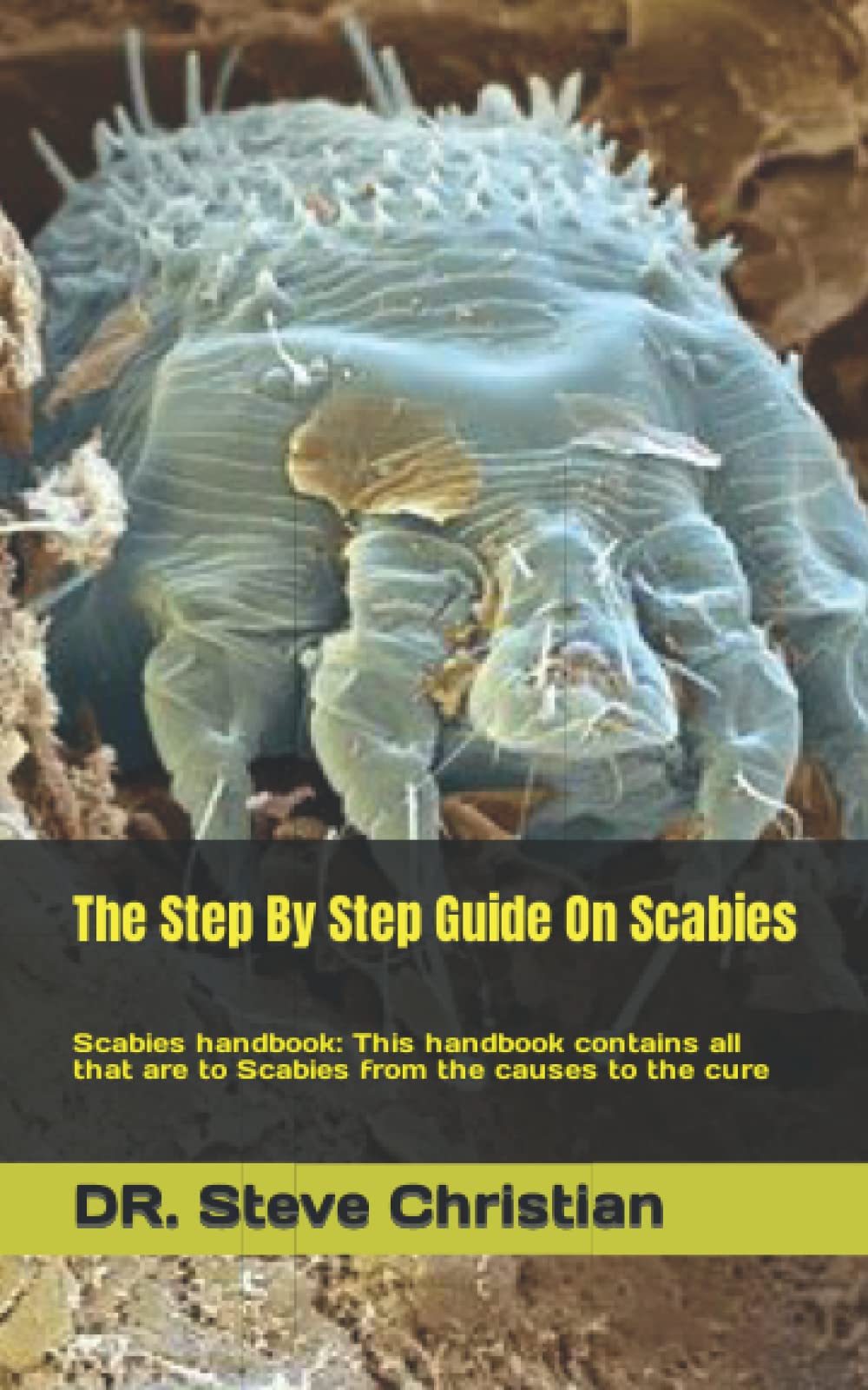 Buy The Step By Step Guide On Scabies.: Scabies handbook: This handbook ...
