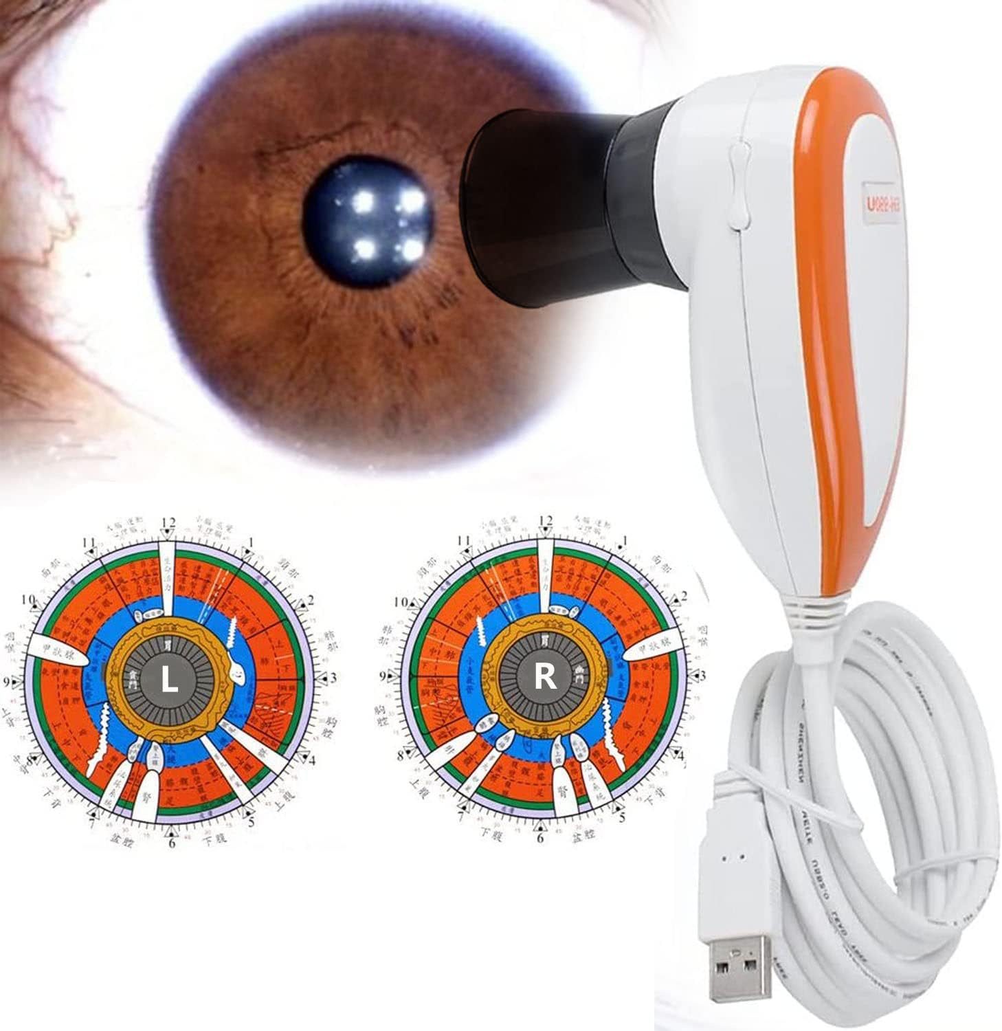 Amazon.com: USB Portable Iris Detector,5.0MP Eye Iridology Camera,HD ...