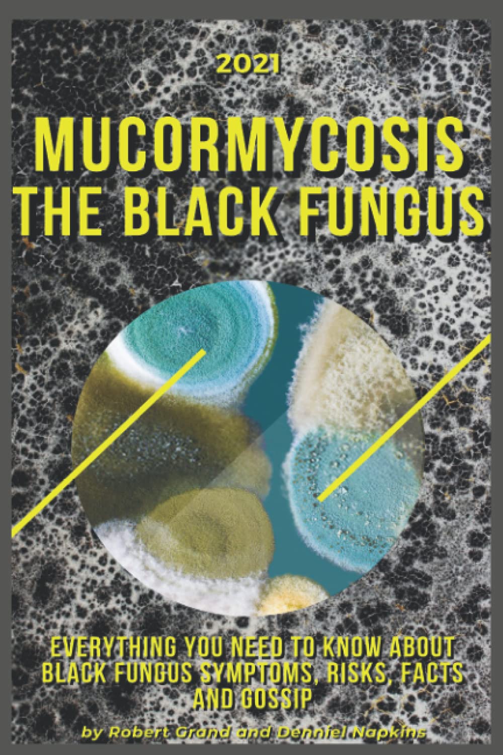 Buy Mucormycosis. The Black Fungus: 2021 Everything You Need to Know ...