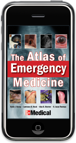 The Atlas of Emergency Medicine, Third Edition: 9780071496186: Medicine ...
