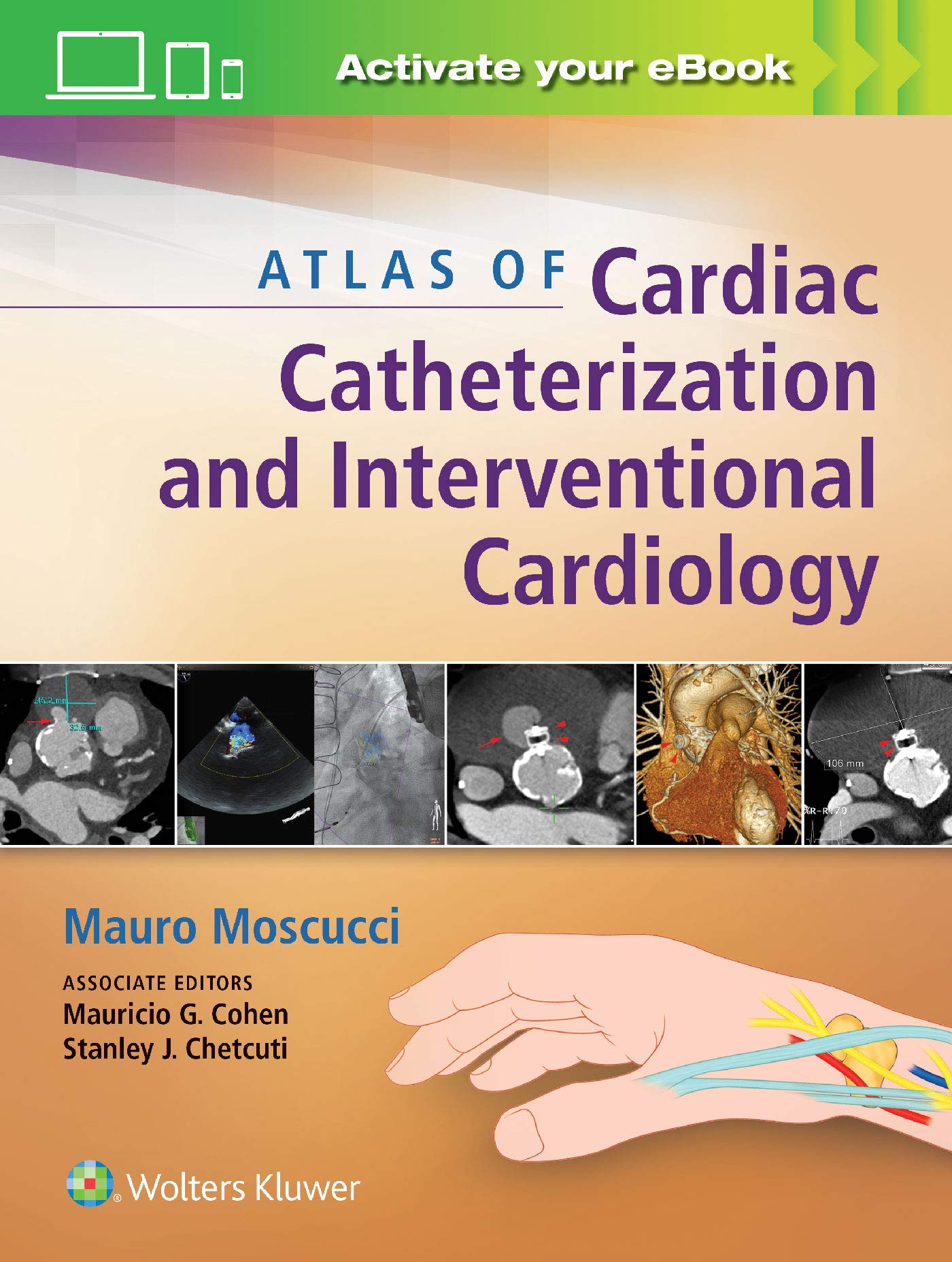 Atlas of Cardiac Catheterization and Interventional Cardiology ...