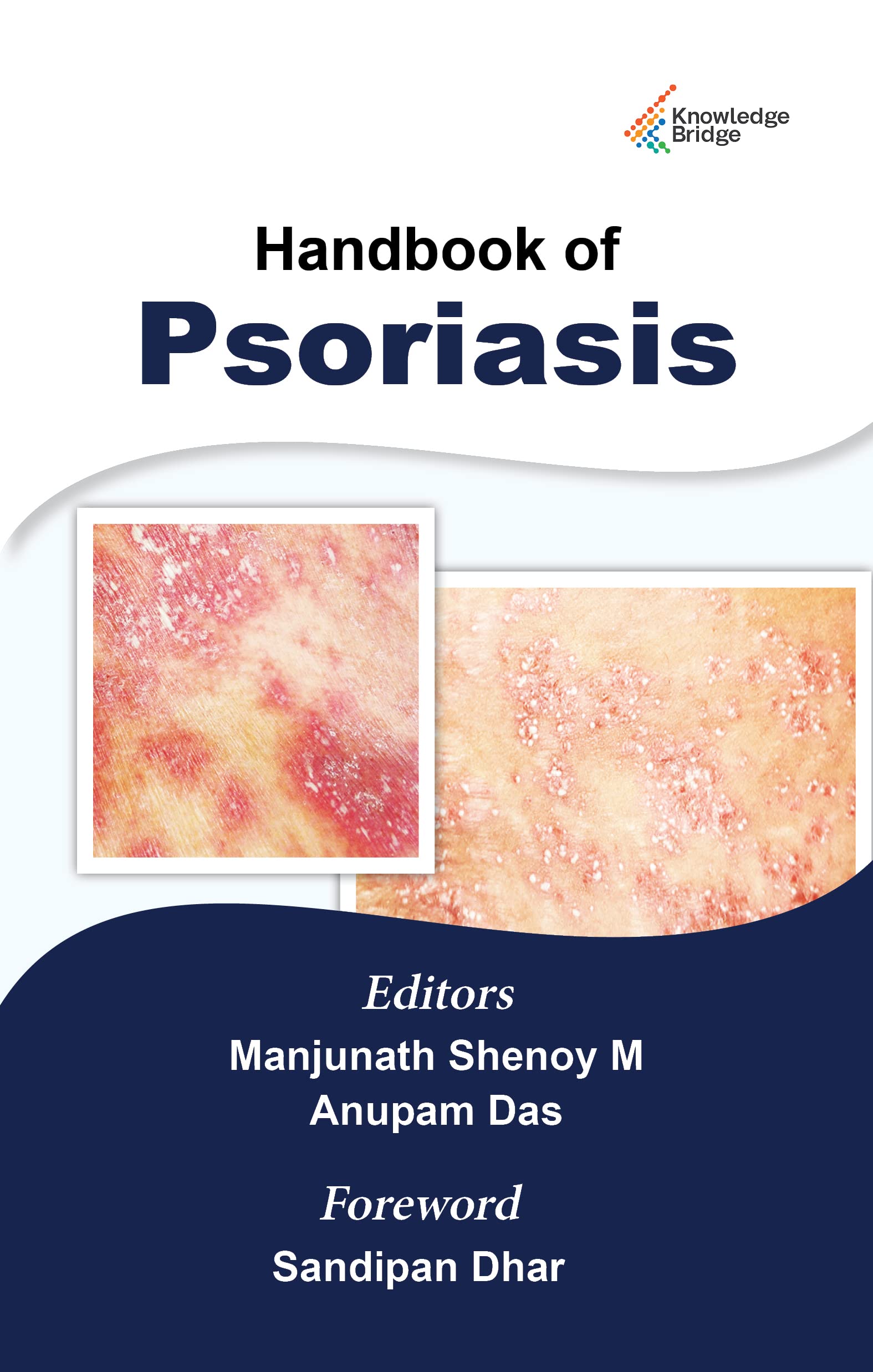Buy Handbook of Psoriasis Book Online at Low Prices in India | Handbook ...