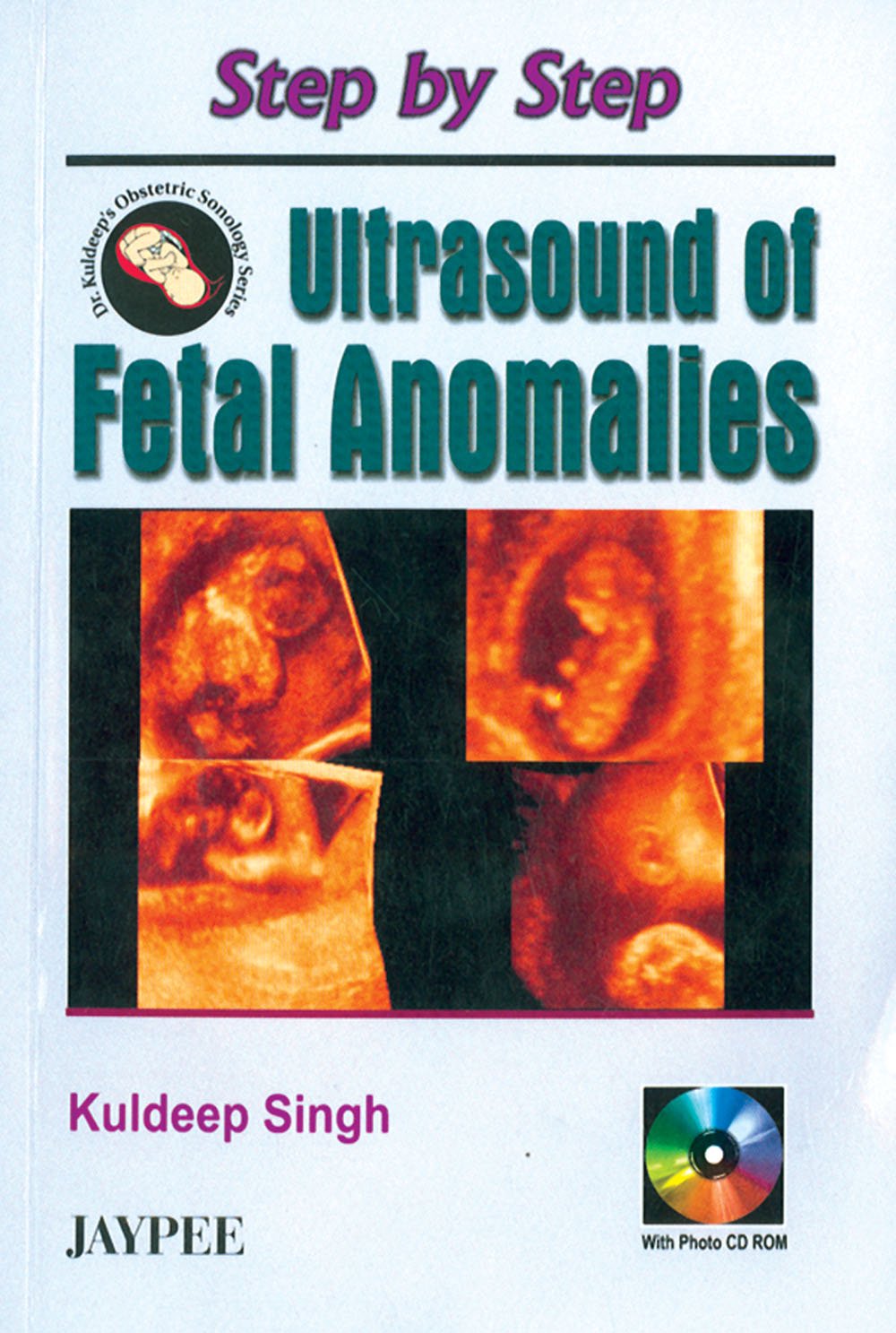 Buy Step by Step Ultrasound of Fetal Anomalies (with Photo CD Rom) Book ...