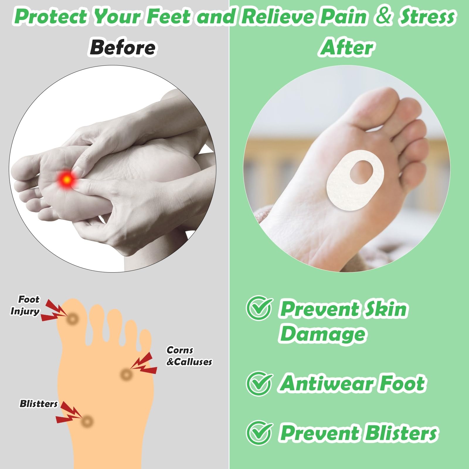 Snapklik.com : Shynek 72 Pcs Callus Pads For Feet, Soft Felt Callus ...