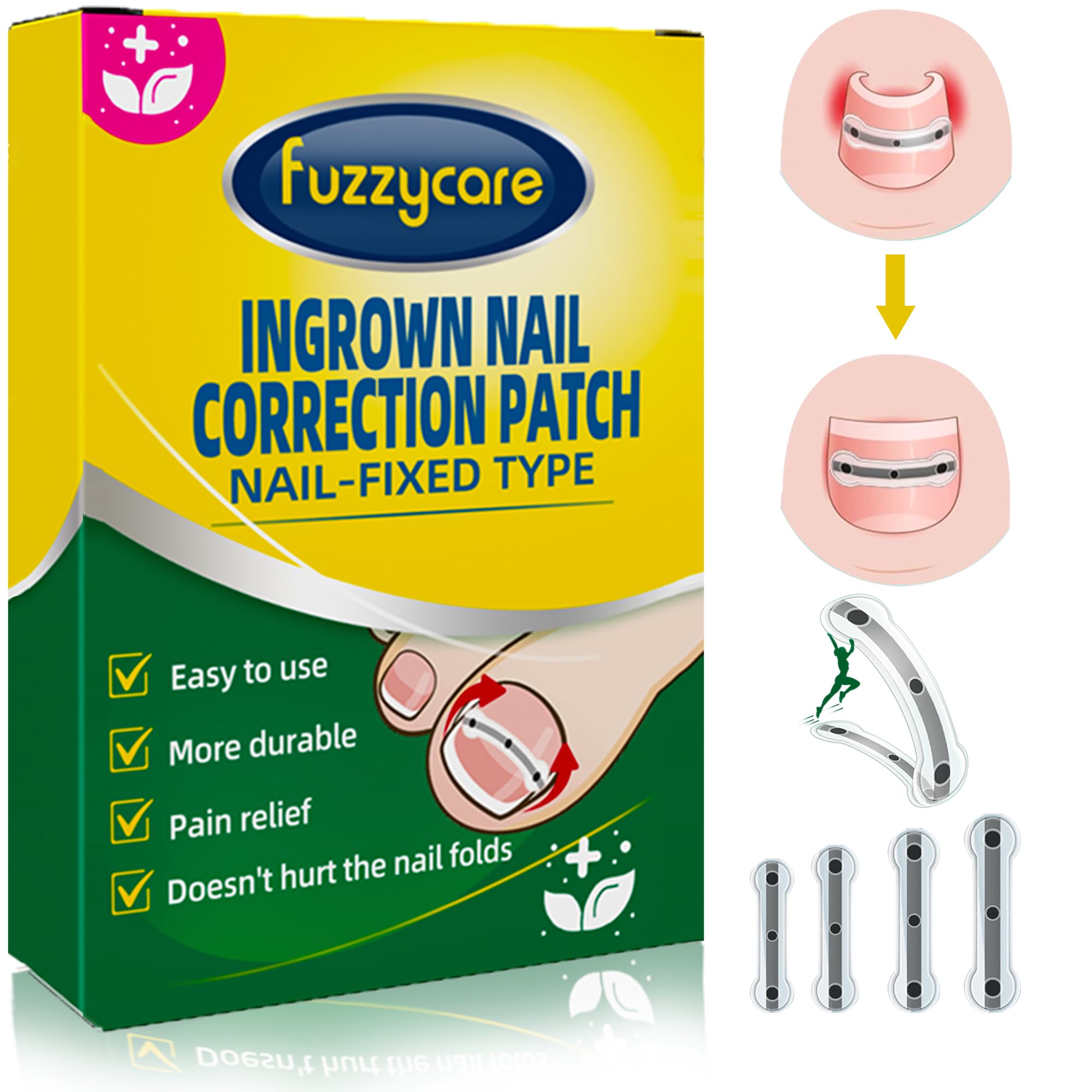 Amazon.com: Titanium Alloy Ingrown Toenail Treatment & Removal Kit for ...