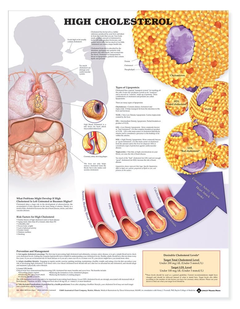 High Cholesterol Anatomical Chart: Anatomical Chart Company ...