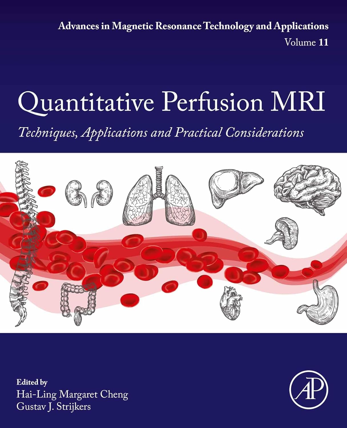 Quantitative Perfusion MRI: Techniques, Applications and Practical Considerations (Advances in ...