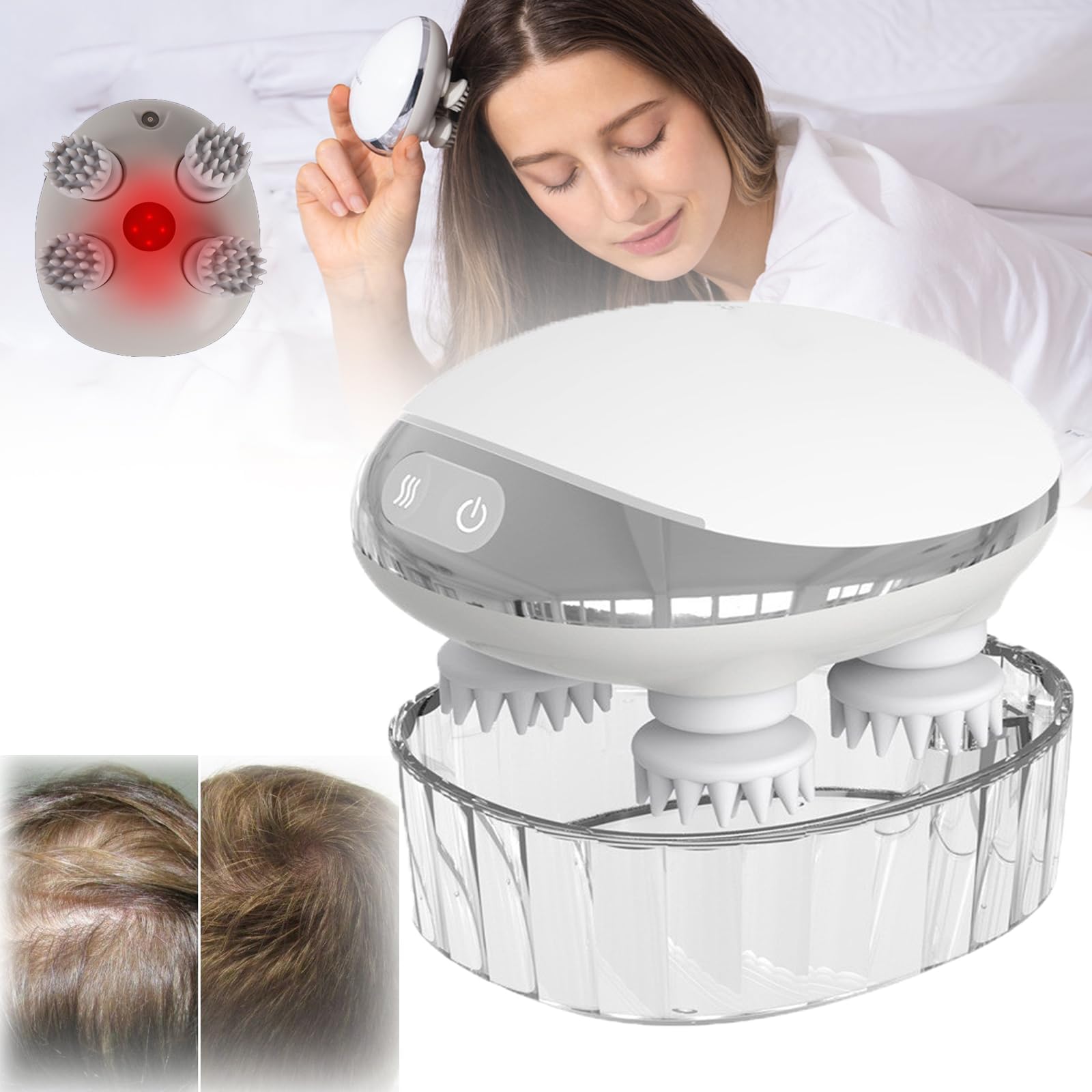 JANGOU Scalphero - Smart Scalp Massager,Scalp Hero Massager with Red ...