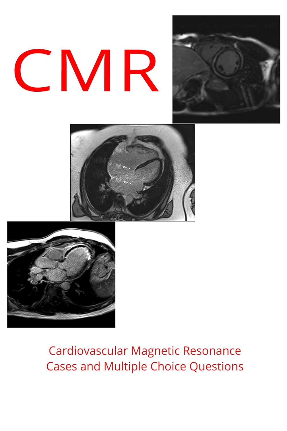 Amazon.com: CMR - Cardiovascular Magnetic Resonance Cases and Multiple ...