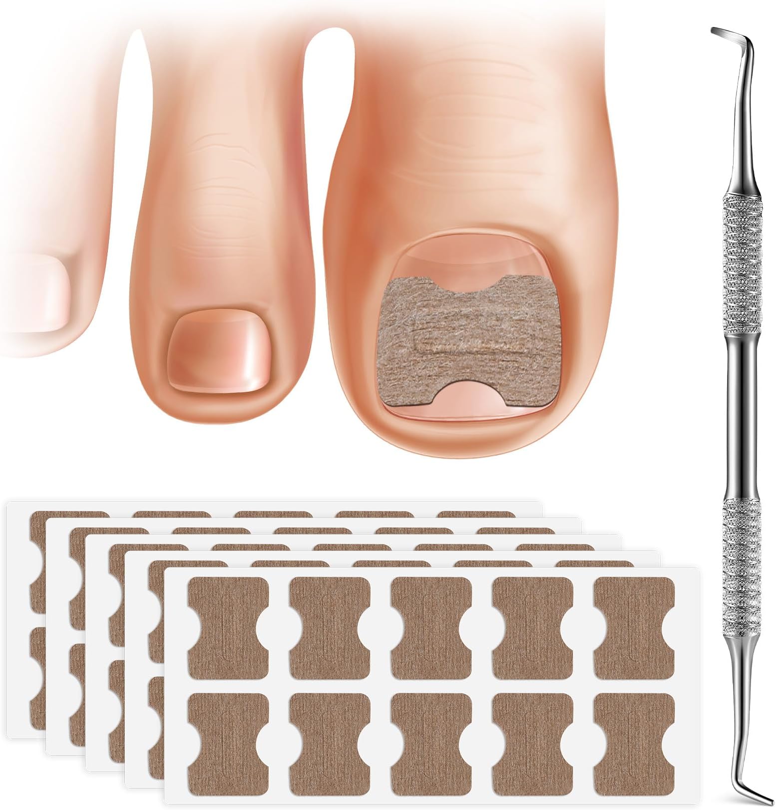 Amazon.com: FERYES 50 PCS Breathable Ingrown Toenail Corrector Patch ...