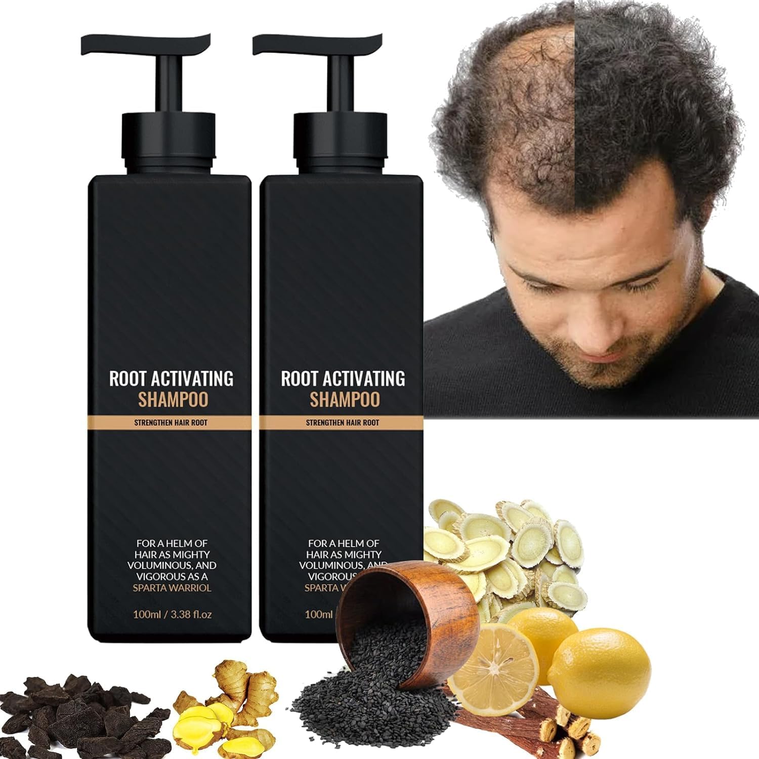 Spartan Root Activator Shampoo Spartan Root Activator Shampoo Regrowth ...