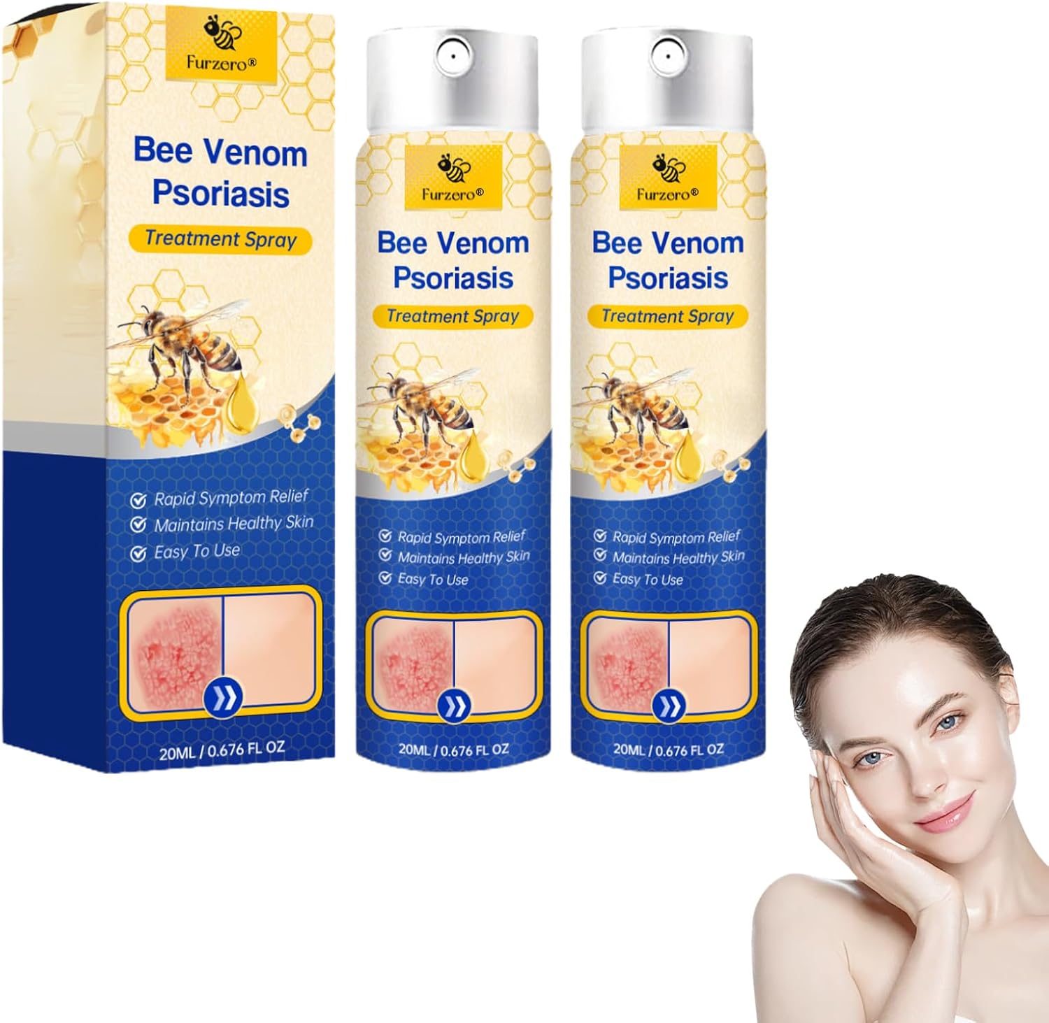 Amazon.com: LOVILDS PsoriaHeal Bee Venom Psoriasis Care Spray pro,2024 ...