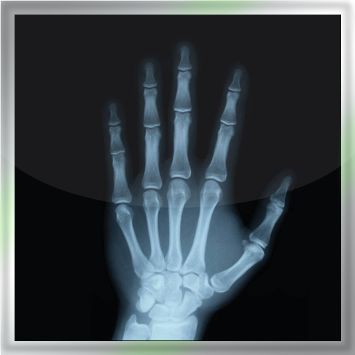 Real X-Ray Scan - App on the Amazon Appstore