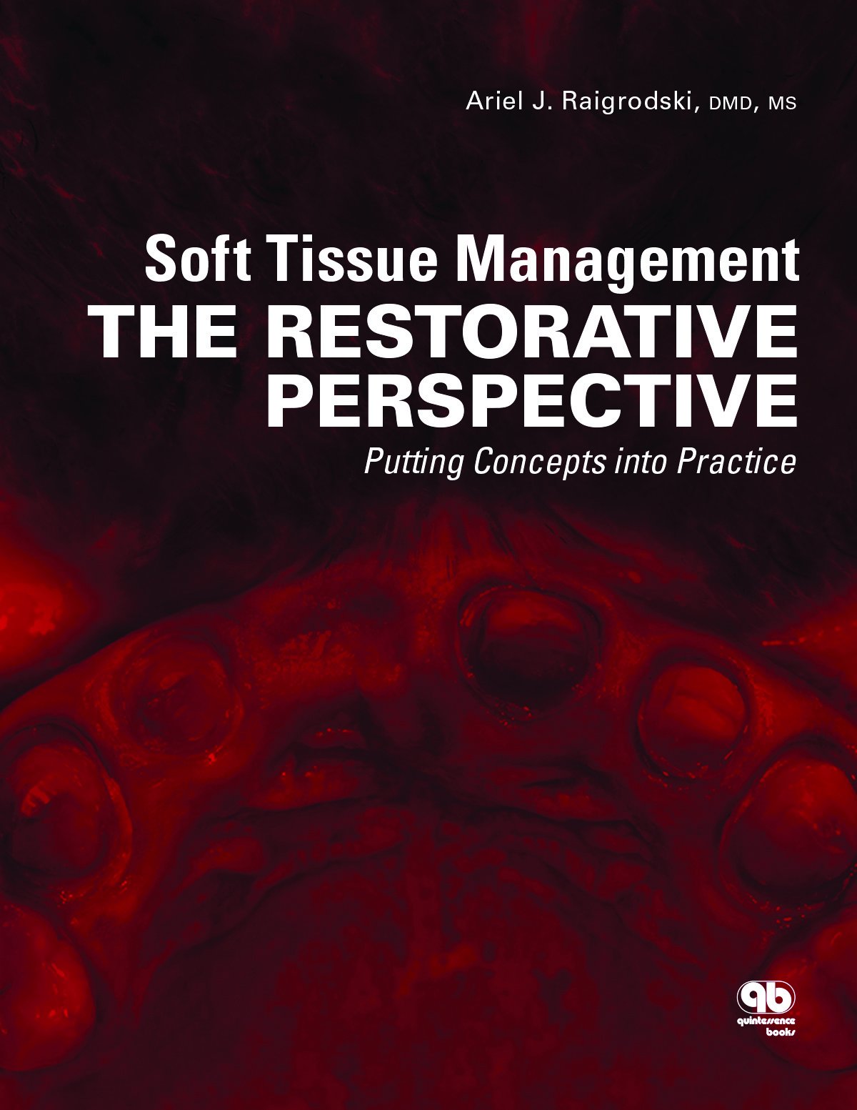 Soft Tissue Management: The Restorative Perspective: Putting Concepts ...